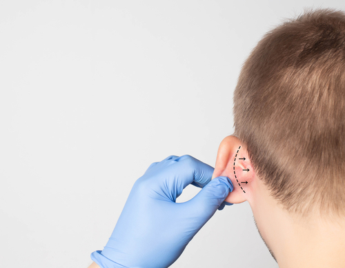 Ear Surgery Sydney NSW - Dr Michael Kernohan Plastic Surgeon