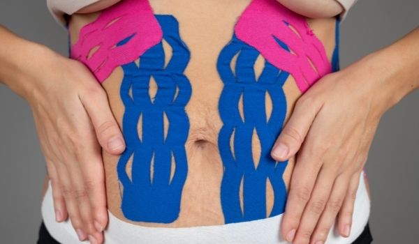 What is Diastasis Recti? - Split Tummy Muscles - Dr Michael Kernohan